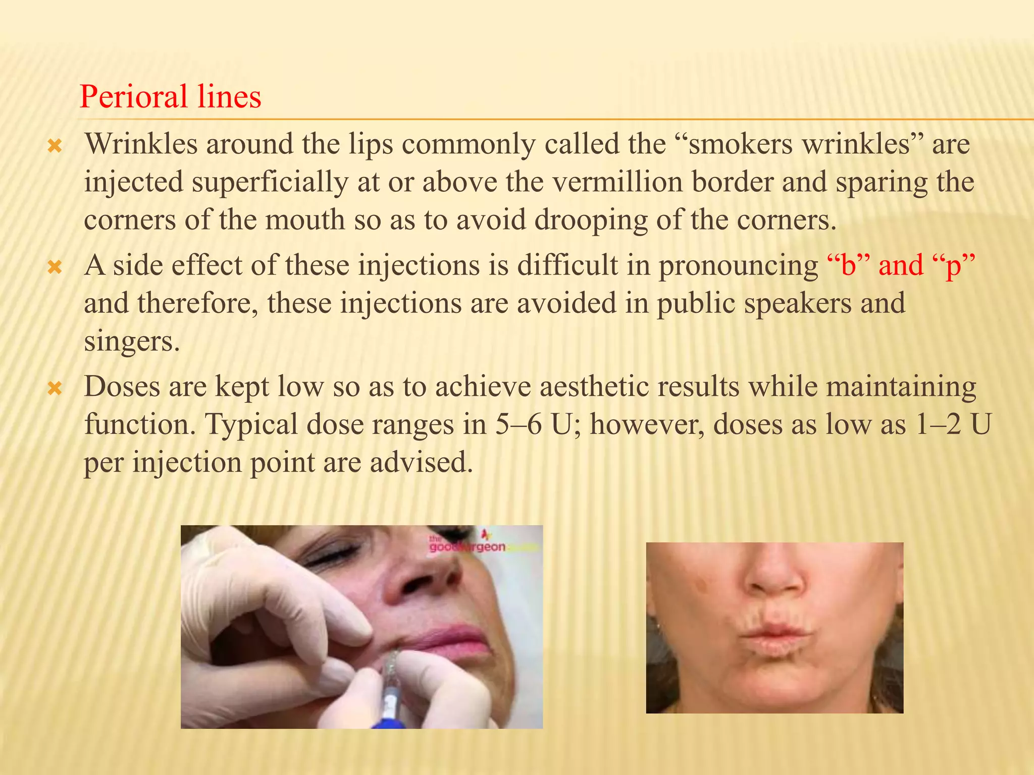 Botulinum toxin and its application in omfs | PPTX