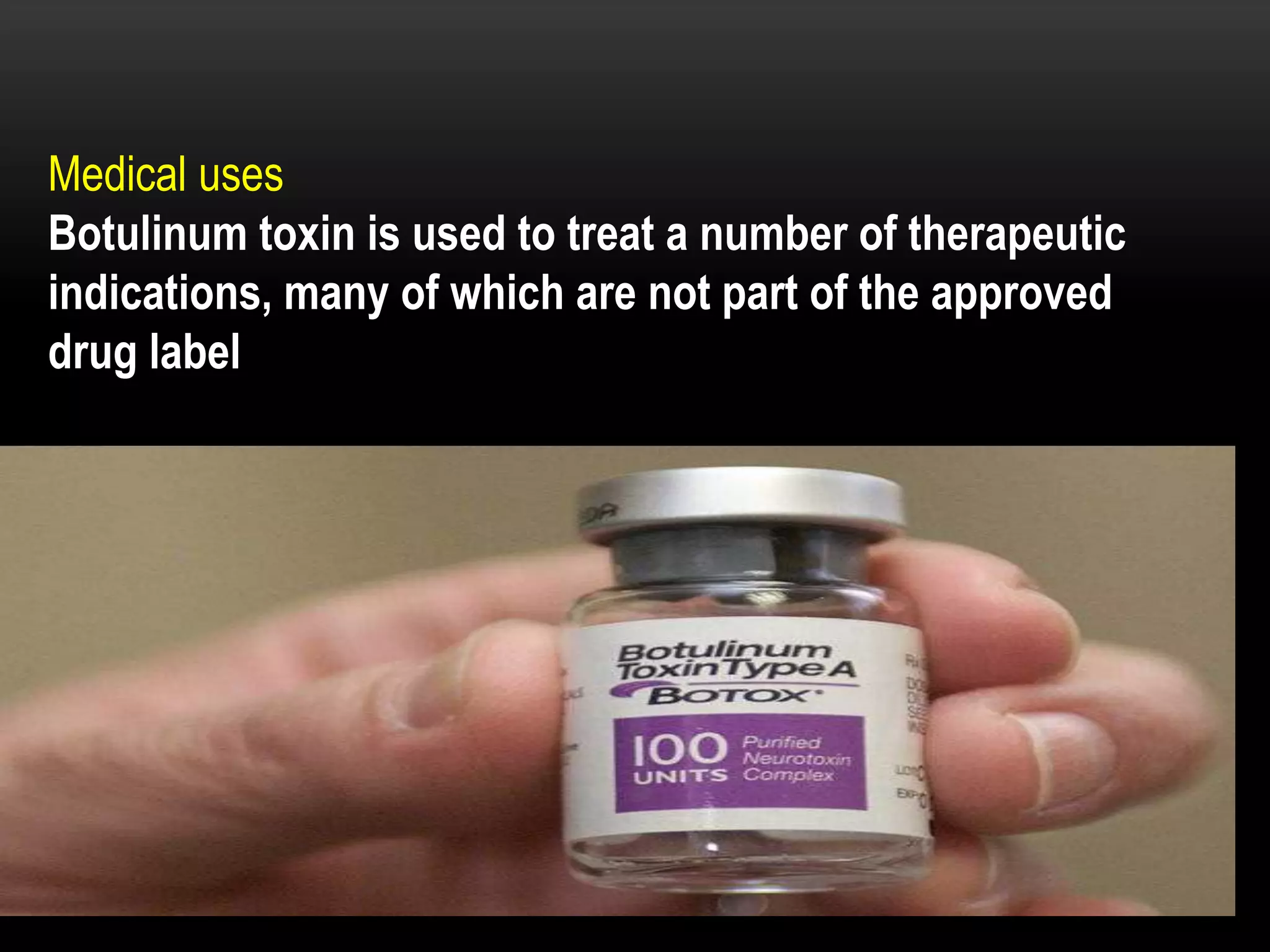 Botulinum toxin | PPTX