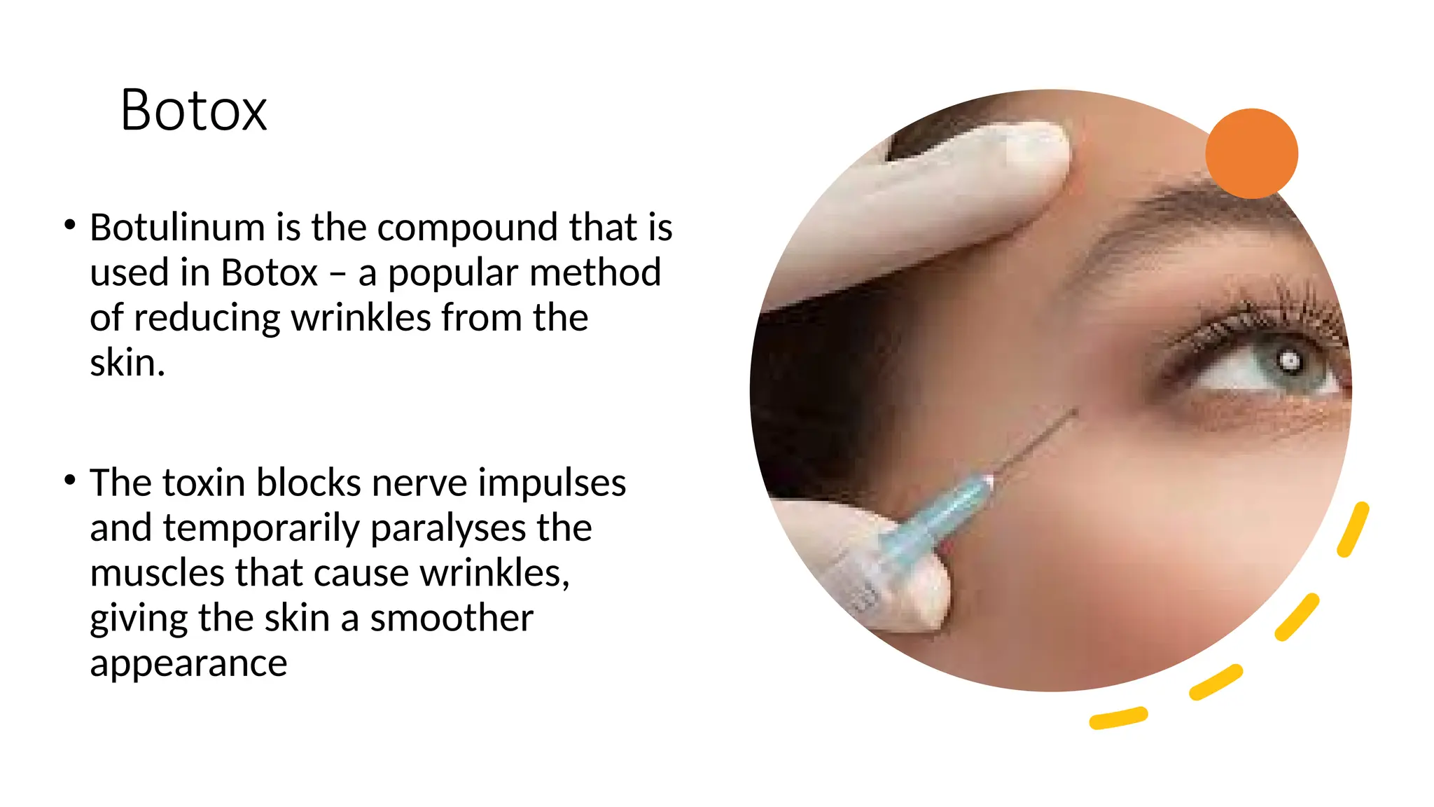 Botulinum toxin-------------------- .pptx