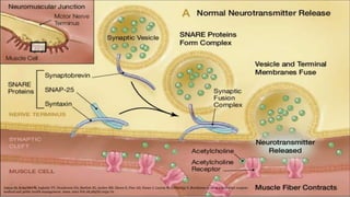 Botulinum Toxin for Neuropathic Pain | PPTX