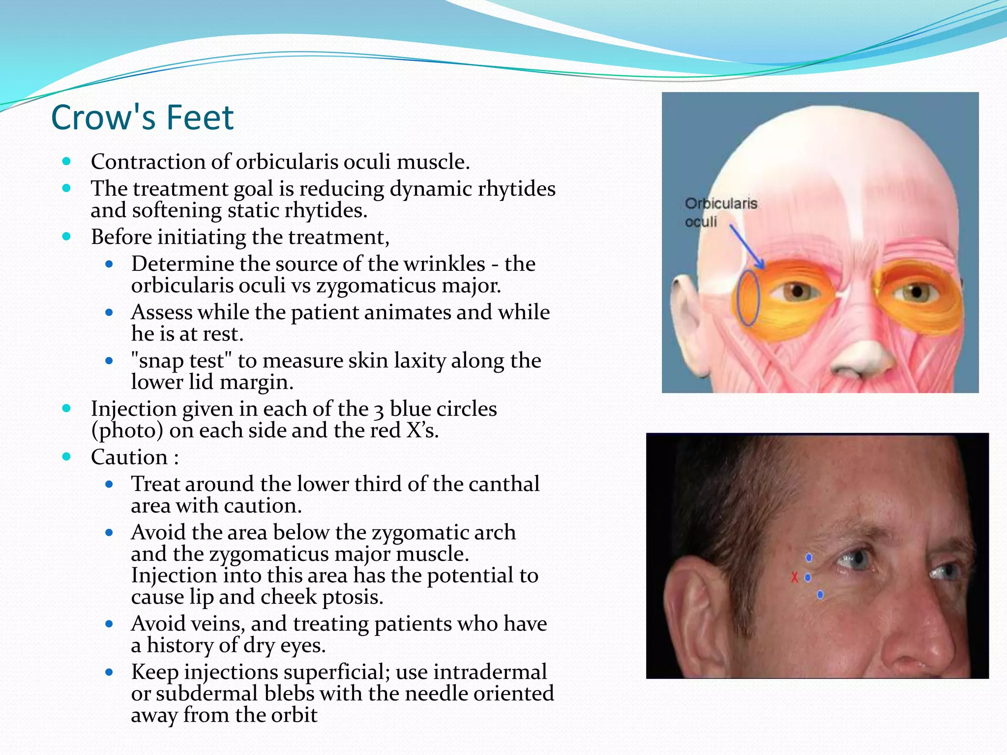 Botulinum toxin in dermatology ppt | PPTX