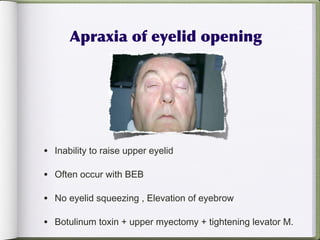 Botulinum toxin in neuro oph | PPT