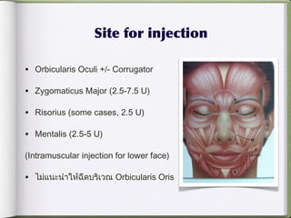 Botulinum toxin in neuro oph | PPT