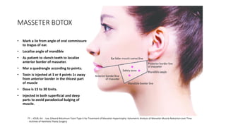 BOTULINUM Toxin lower face- Dr Rabia Ghafoor.pdf