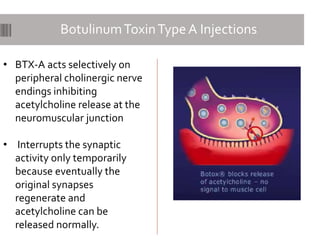 Botulinum toxin type A injections | PPTX