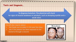 Botulism | PPTX