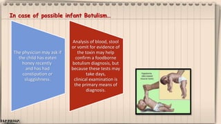 Botulism | PPTX
