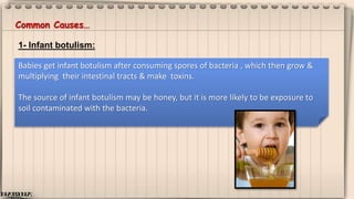 Botulism | PPTX