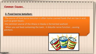 Botulism | PPTX