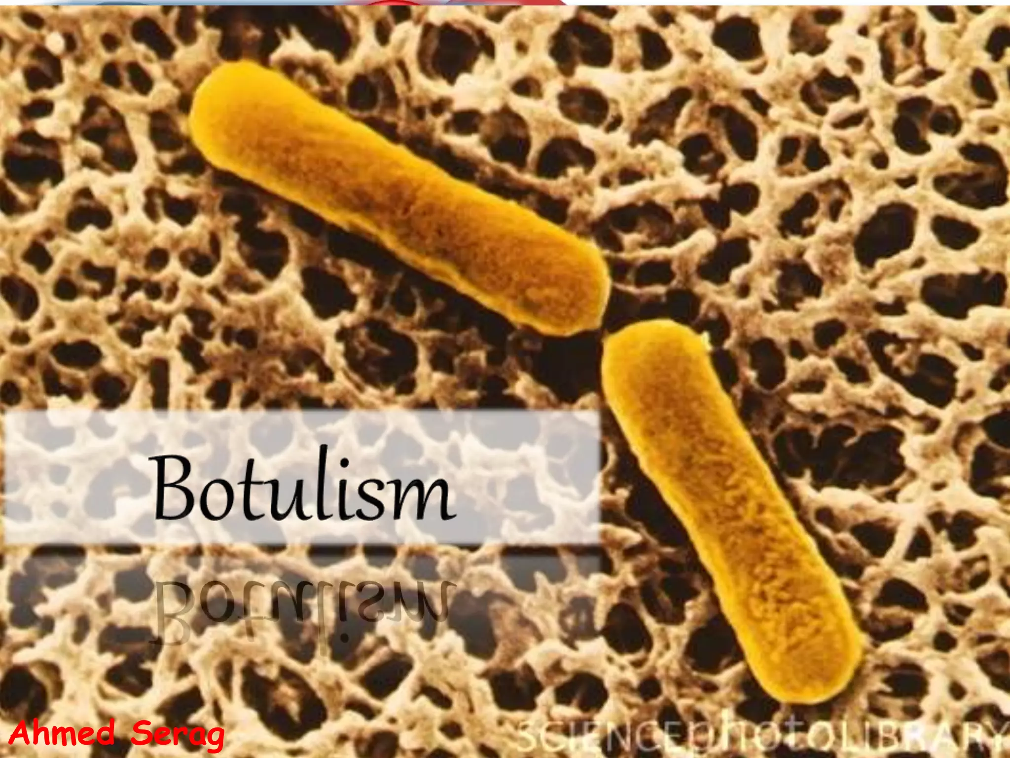 Botulism | PPSX
