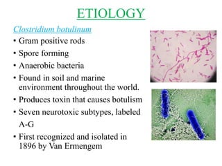 Botulism | PPT