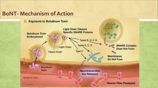 Botulism | PPT
