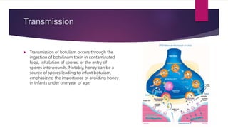 Understanding Botulism: Causes, Symptoms, Diagnosis, Treatment, and ...