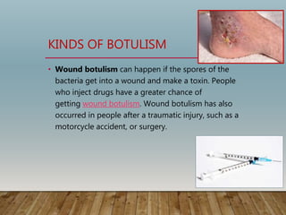 Wound Botulism