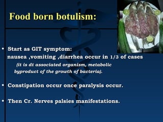 Signs Of Botulism Meat
