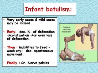 Botulism 2019 | PPT