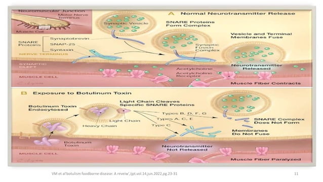 Botulism Foodborne Disease.pptx