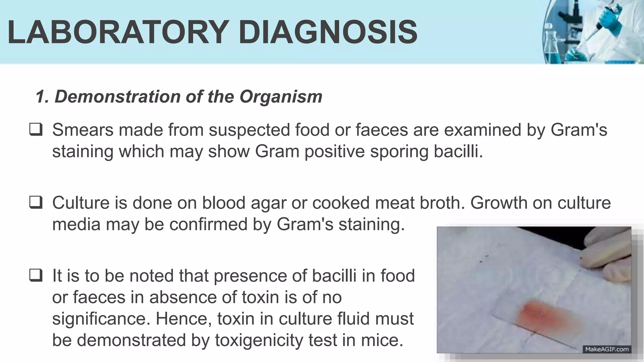 Botulism, Food Poisoning | PPTX