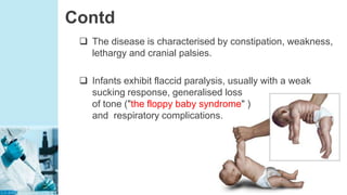 Botulism, Food Poisoning | PPTX