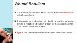 Botulism, Food Poisoning | PPTX