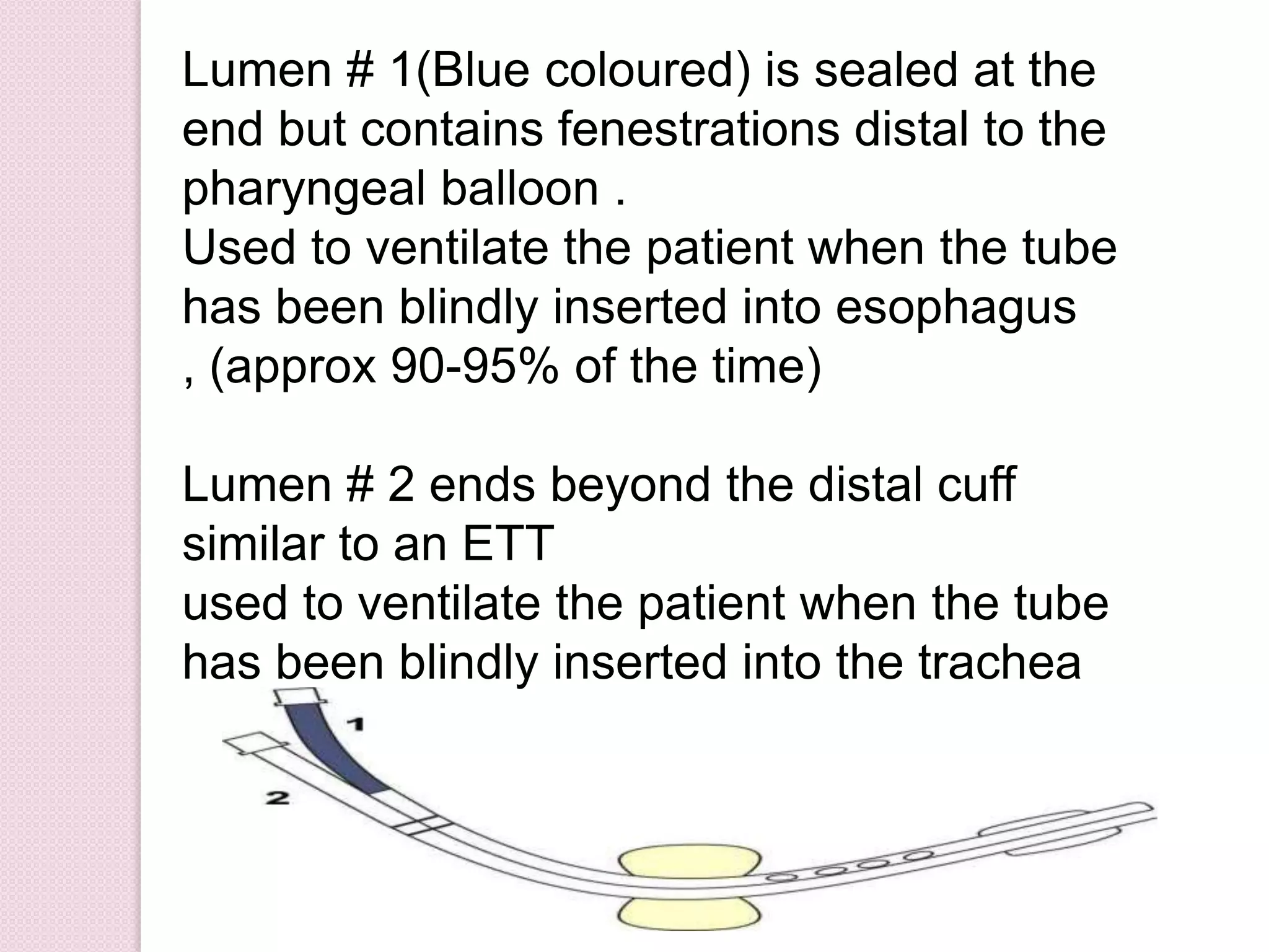 Bougie, trachlite , laryngeal tube , combitube , i gel ,truview | PPTX