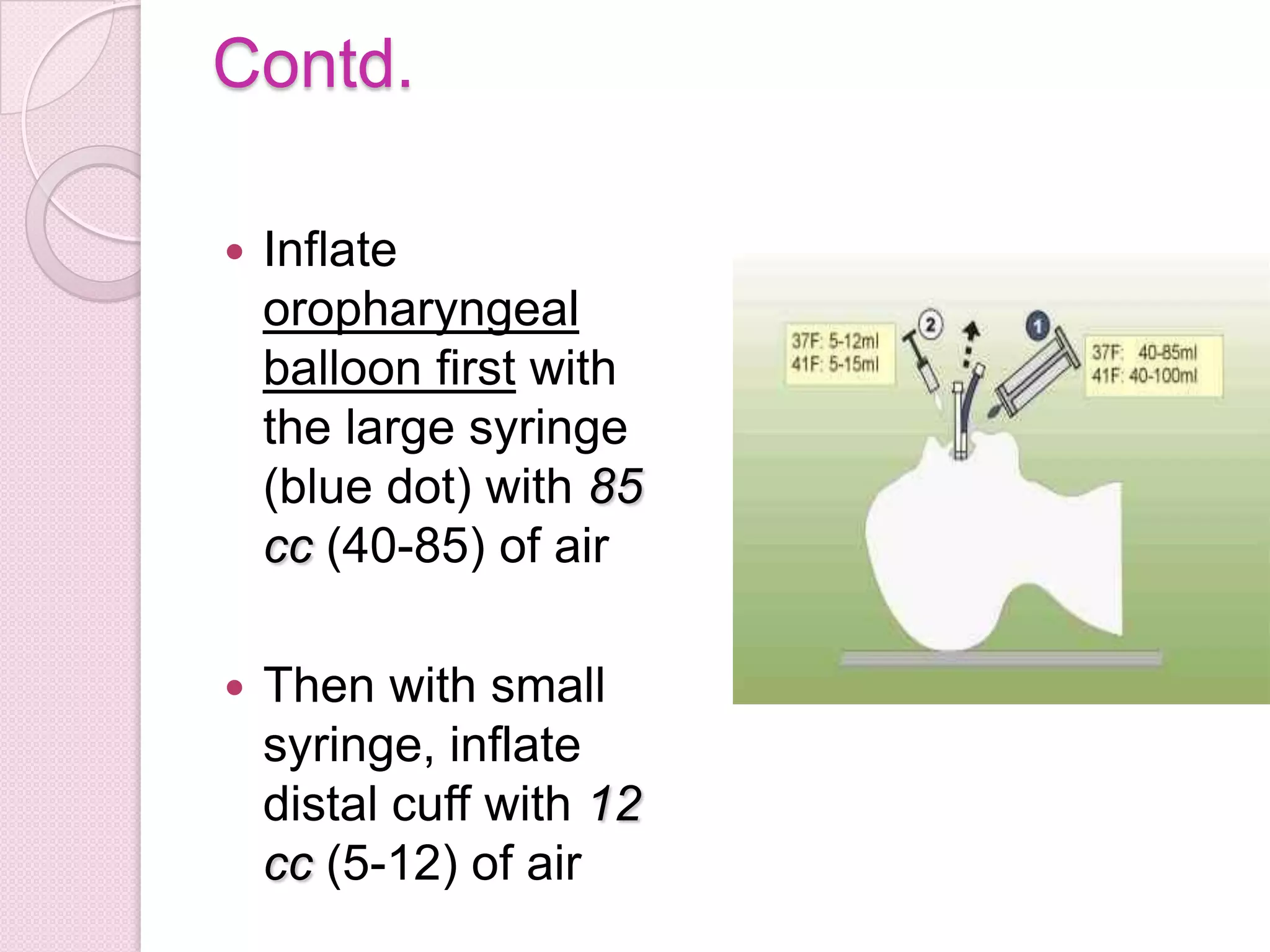 Bougie, trachlite , laryngeal tube , combitube , i gel ,truview | PPTX