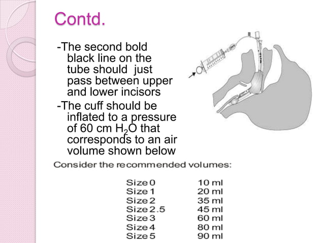 Bougie, trachlite , laryngeal tube , combitube , i gel ,truview | PPT