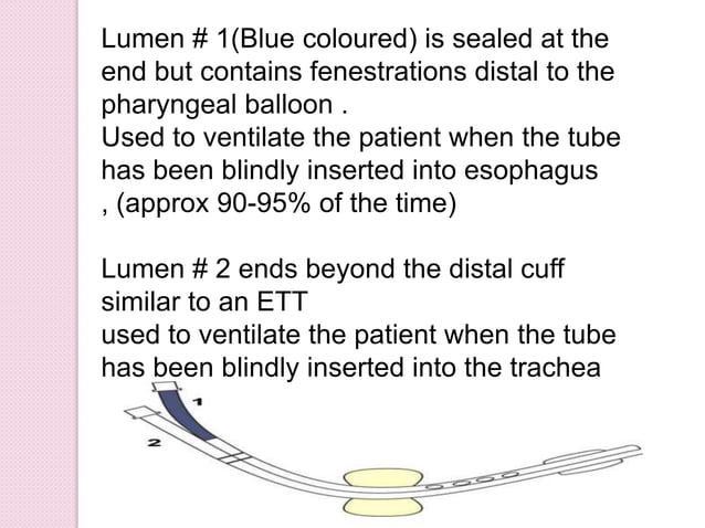 Bougie, trachlite , laryngeal tube , combitube , i gel ,truview | PPTX ...