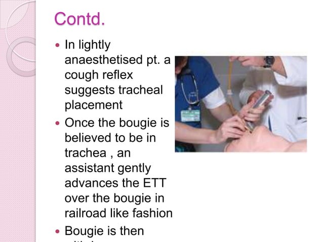 Bougie, trachlite , laryngeal tube , combitube , i gel ,truview | PPTX ...