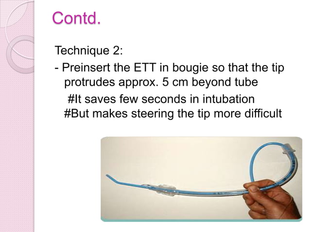 Bougie, trachlite , laryngeal tube , combitube , i gel ,truview | PPTX ...