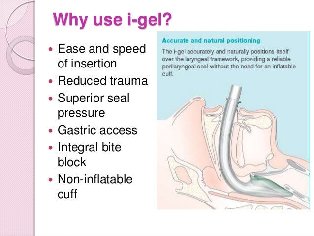 Bougie, trachlite , laryngeal tube , combitube , i gel ,truview