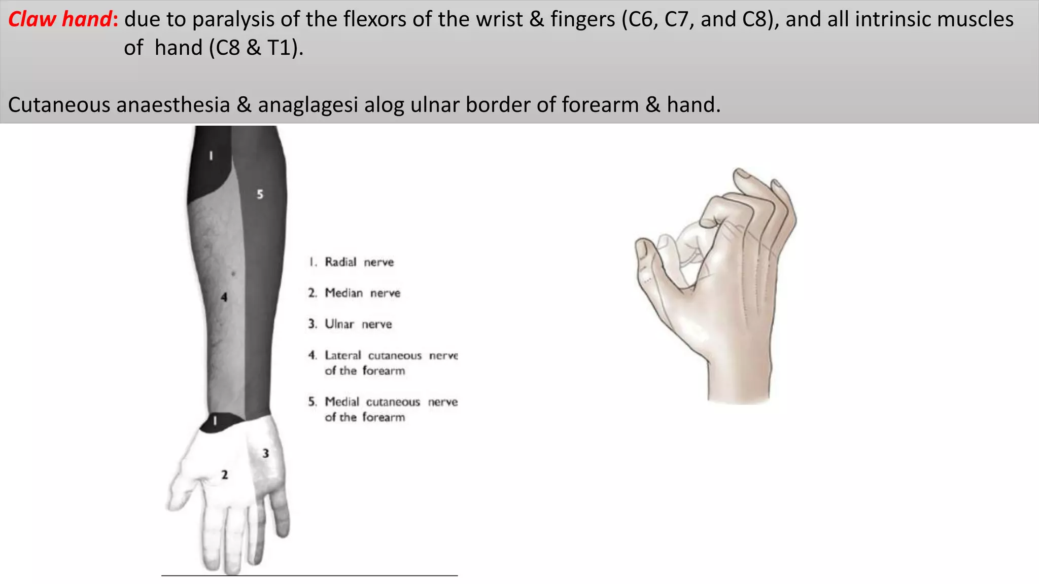 Boundaries & contents of Axilla | PPTX