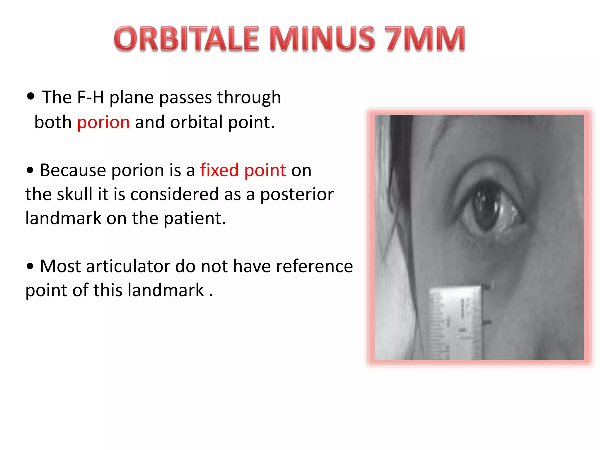orientation jaw relation | PPTX