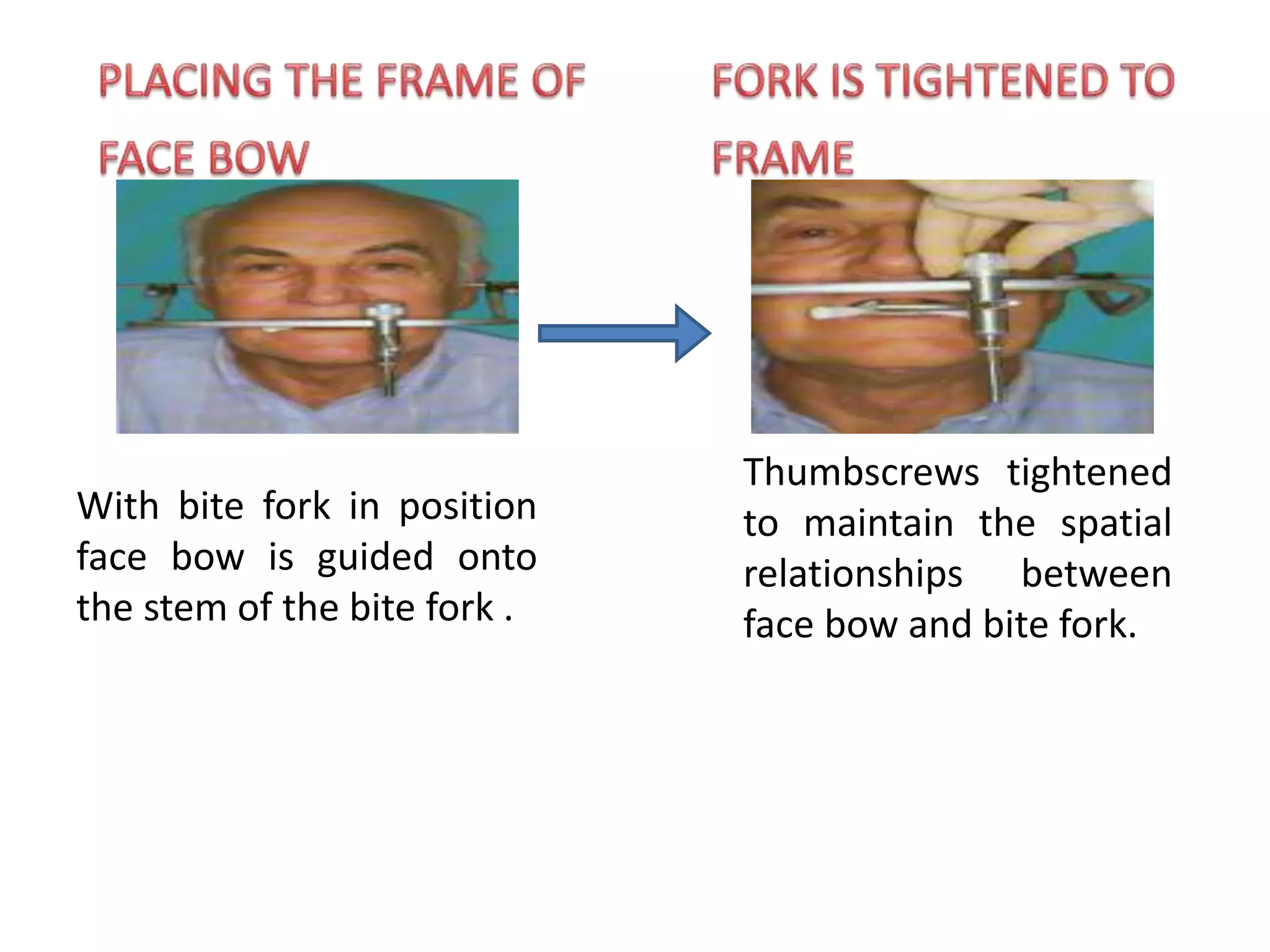 orientation jaw relation | PPTX