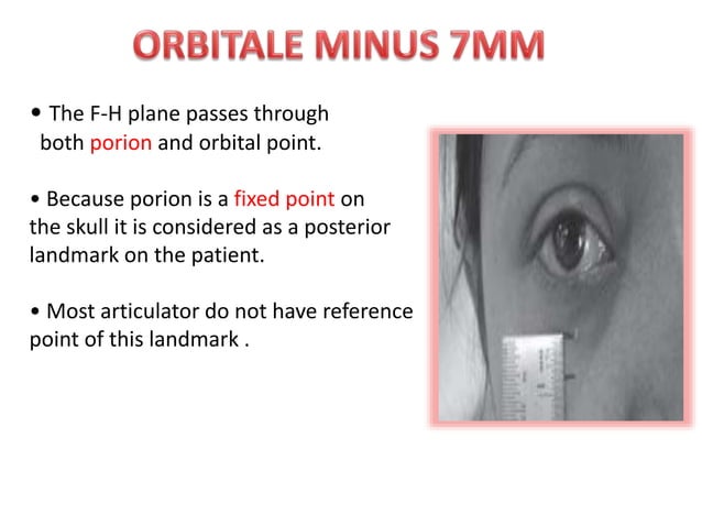 orientation jaw relation | PPTX