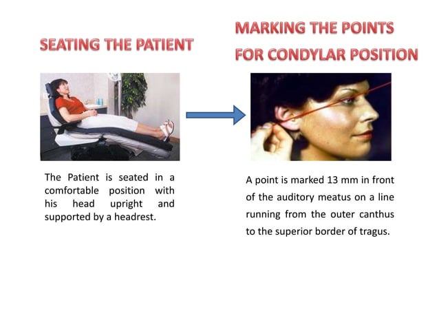 orientation jaw relation | PPTX