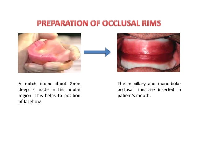 orientation jaw relation | PPTX