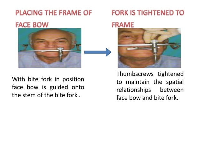 orientation jaw relation | PPTX