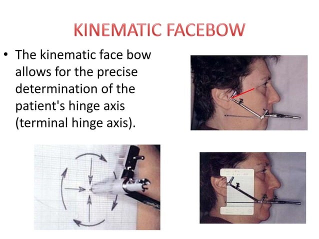 orientation jaw relation | PPTX