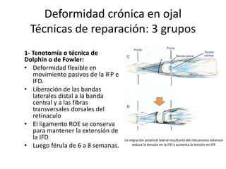 BOUTONNIERE MANEJO QUIRURGICO.pptx