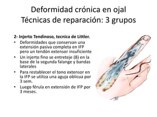 BOUTONNIERE MANEJO QUIRURGICO.pptx