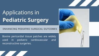 Bovine Pericardial Tissue Patch for Pediatric Surgery | PPTX