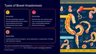 Bowel-Anastomosis-Principles-and-Techniques (1)-compressed-compressed ...