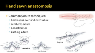 Bowel anastomosis | PPTX | Digestive Disorders | Diseases and Conditions