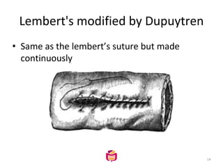 Bowel anastomosis - Why we do things the way we do? | PPTX