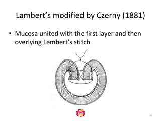 Bowel anastomosis - Why we do things the way we do? | PPTX