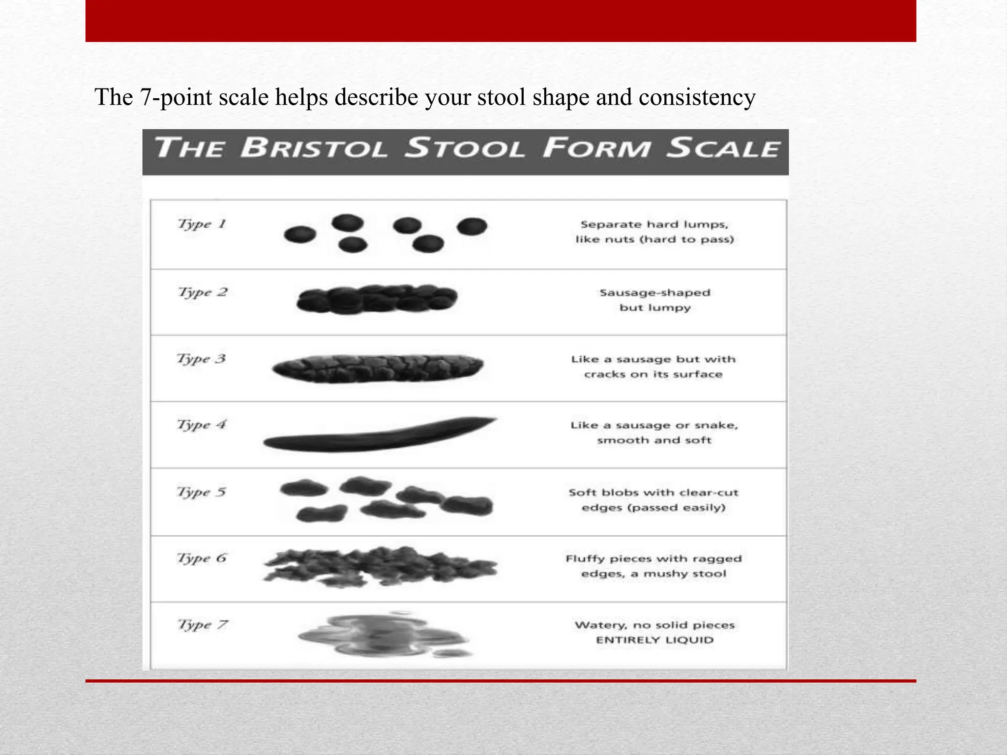 Bowel and ball and Anorectal Dysfunction.pptx