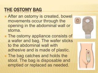 Bowel elimination | PPTX