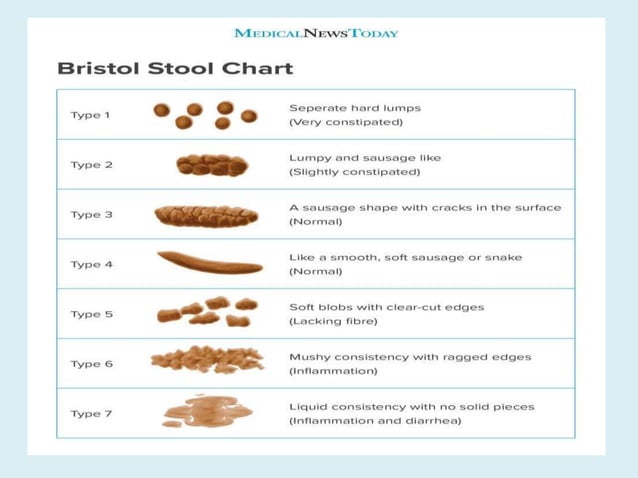 Bowel elimination ppt | PPTX | Digestive Disorders | Diseases and ...