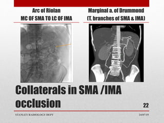 Ischaemic bowel - imaging | PPTX